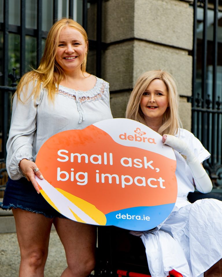 Wild Rover Tours Joins Forces with Debra to Battle EB - Wild Rover Tours